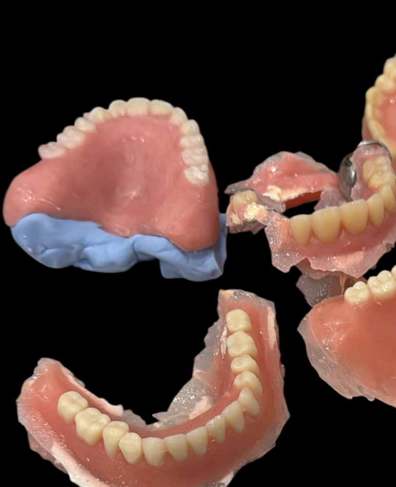 Our Denture Services – Echo Dental Solutions
